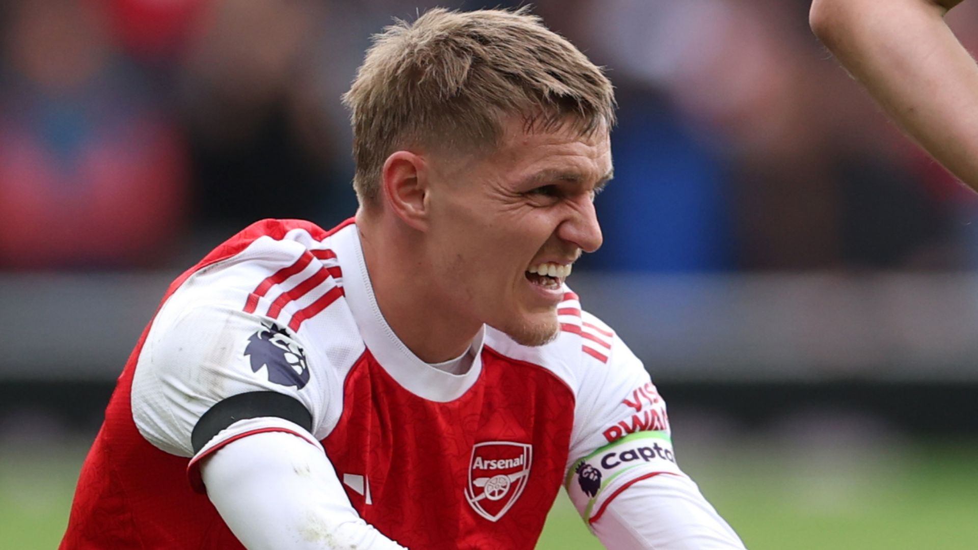 Martin Odegaard and Arsenal offered concerning update on midfielder's injury by ex-Norwegian ...